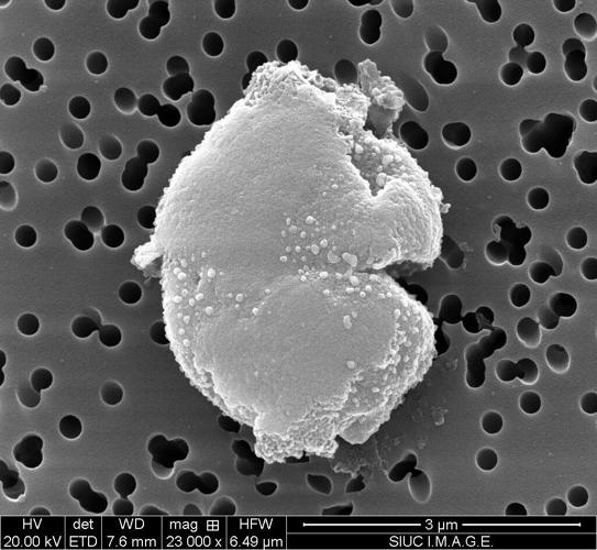 SIU team gets $170K grant to continue research to stop toxins from ...