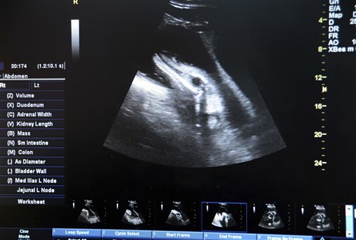 3 Brookfield Zoo dolphins expecting