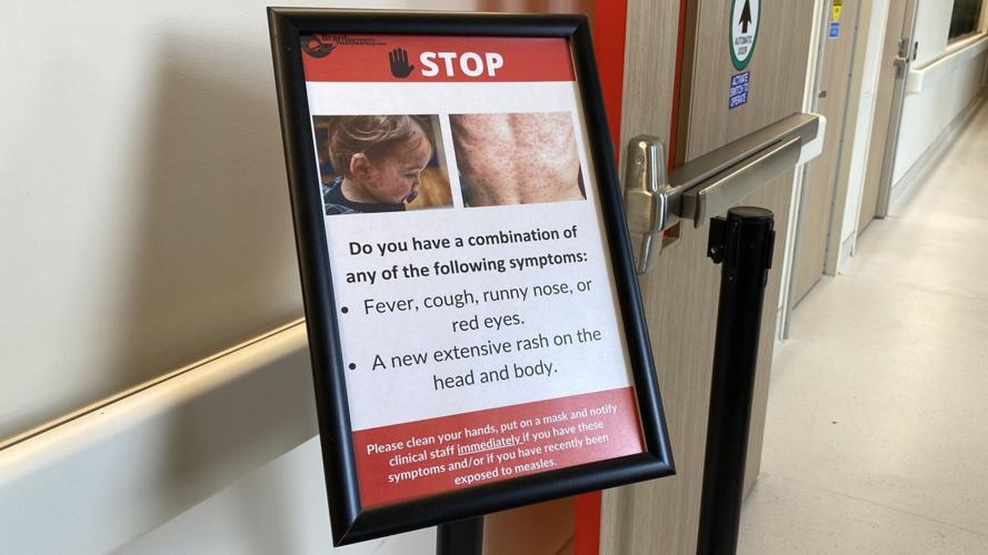 What you need to know about measles if you’re having a baby