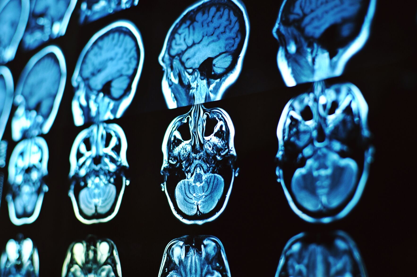Scientists identify drug that could slow brain cancer