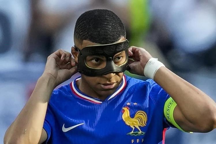 More changes to Mbappé face mask as France star's Euro 2024 problems ...
