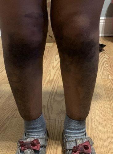 Hamilton to look for source of lower-city soot and grime