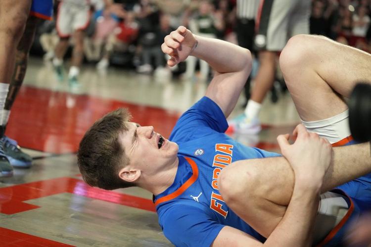 Florida's Alex Condon will wear a mouthpiece moving forward following ...