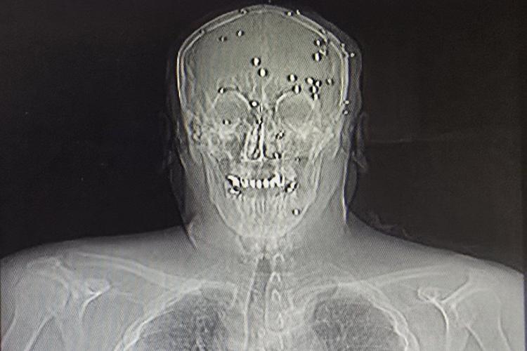 AP reporter speaks to Iranian doctors who say agents intimidated them ...