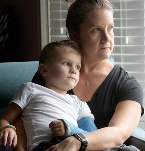 Four-year-old waits days for emergency elbow surgery