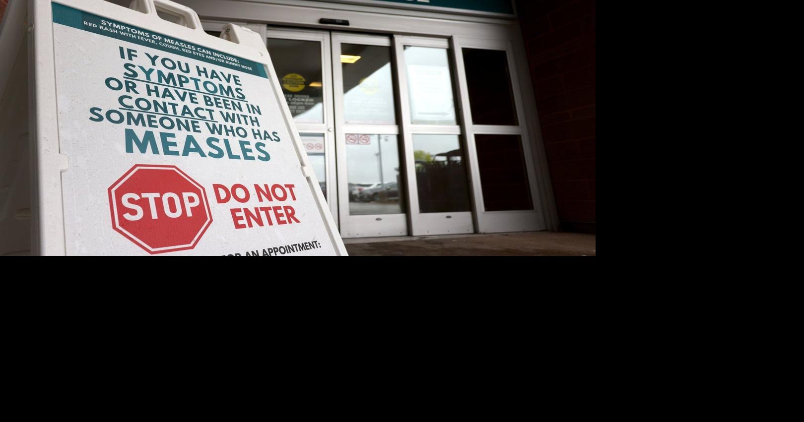 Public health warns of measles exposure at Fort St. John, B.C ...