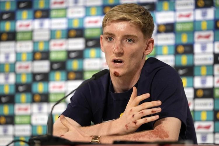 England winger Gordon escapes serious injury from bike accident during ...