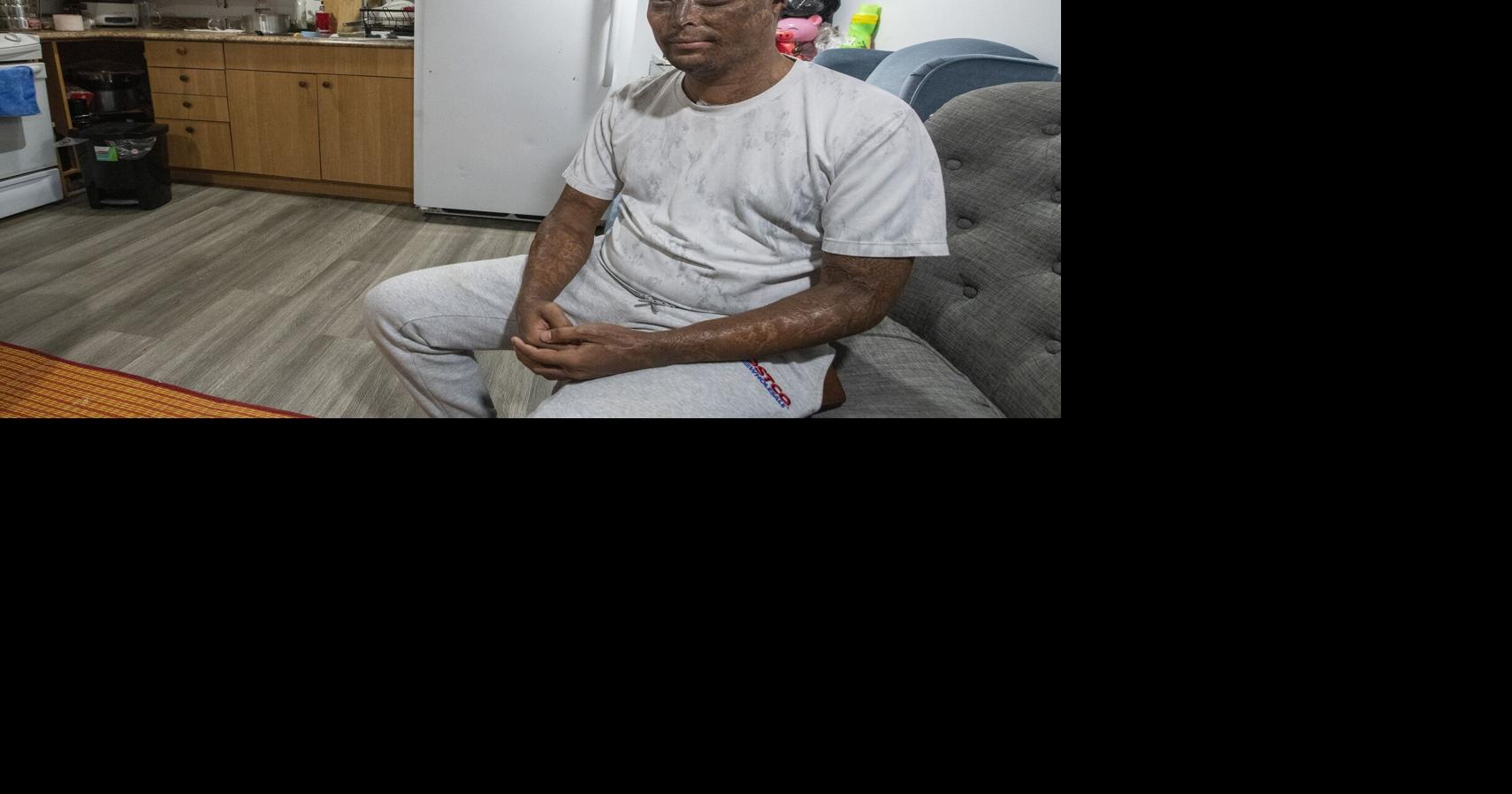 How a surgeon gave a Hamilton dad his voice back
