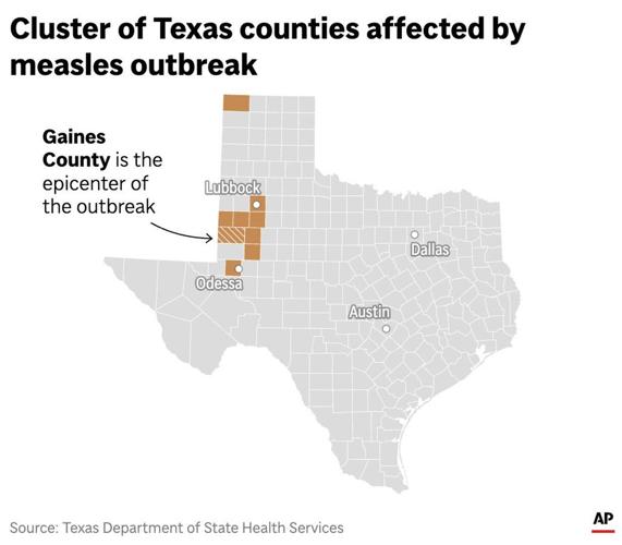 West Texas reports nearly 200 measles cases. New Mexico is up to 30