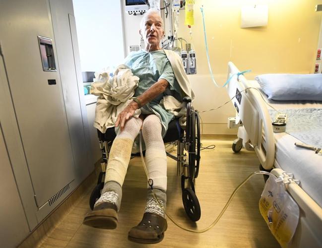 Burn unit rises again at Hamilton General Hospital