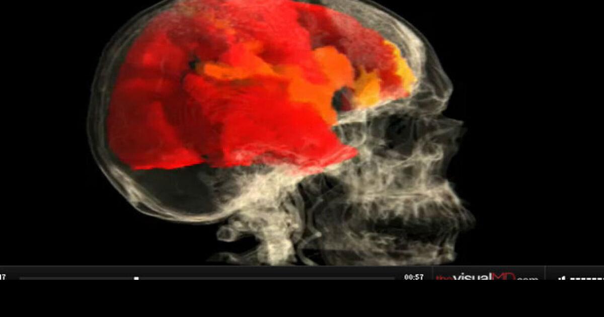 What a woman’s brain looks like during sex