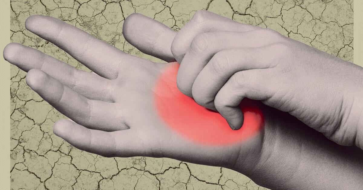 Are you always itchy? Here’s why, according to doctors