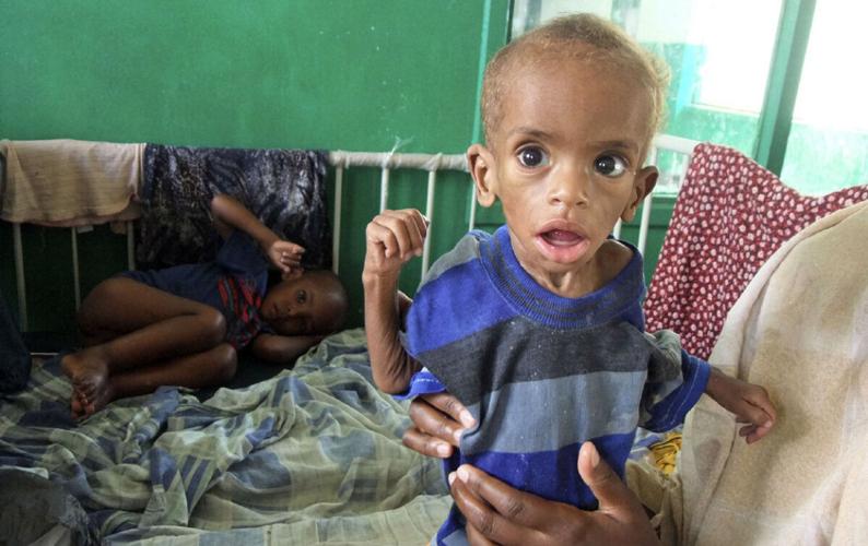 Why aid can’t get to starving Somalians