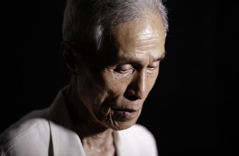 Powerful AP photos show the scars of a survivor of the Nagasaki atomic ...