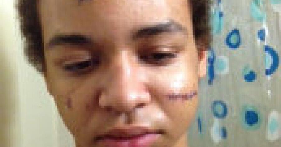 Wired glass linked to ‘horrible injuries’