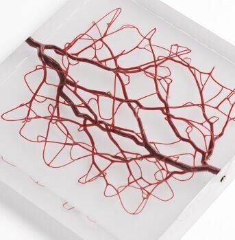 Bioprinted tissues are changing how we study and treat disease