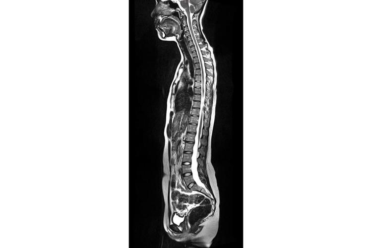 Celebrities are getting $2,000 MRI scans to learn about their health. Should you?