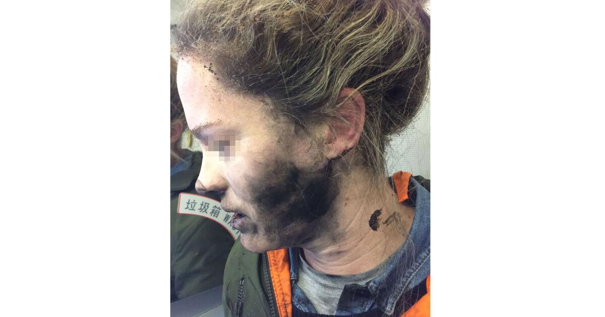 Woman burned after battery-powered headphones explode on flight