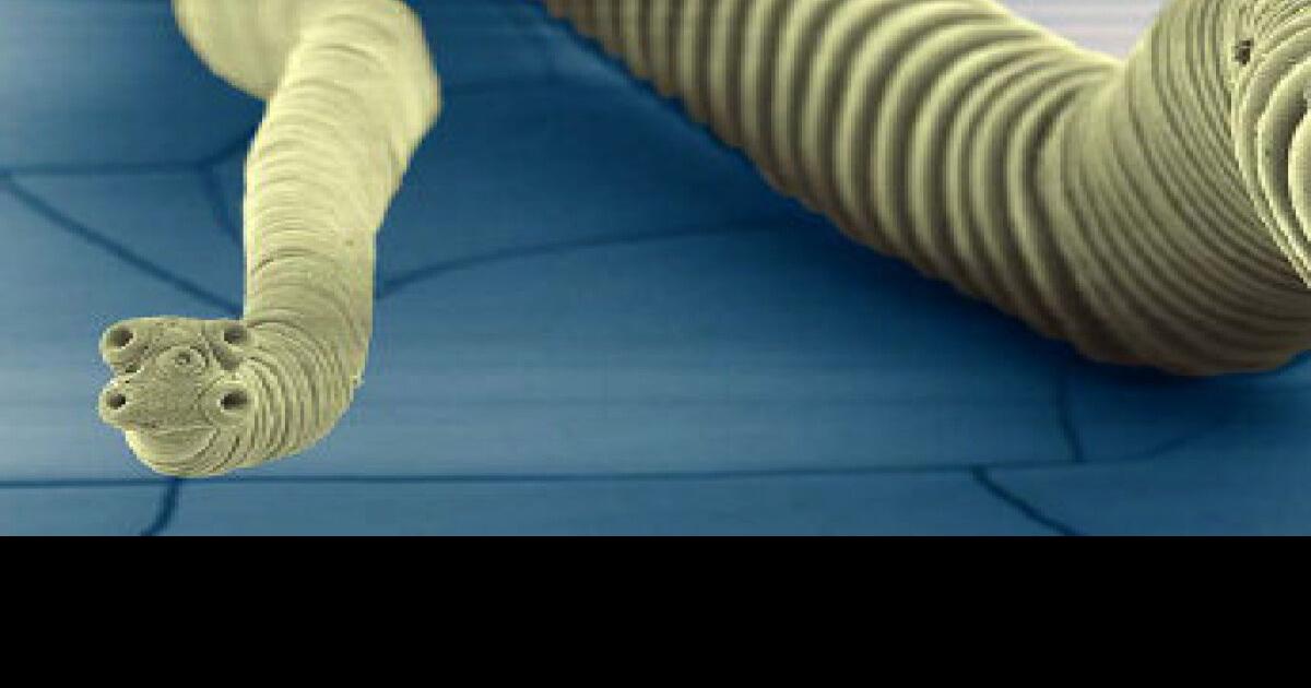 The case of the man whose cancer came from a tapeworm