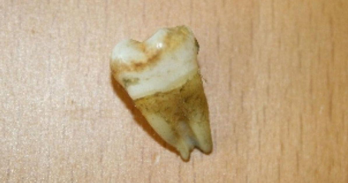 John Lennon’s tooth unlikely to help resurrect Beatle, expert says