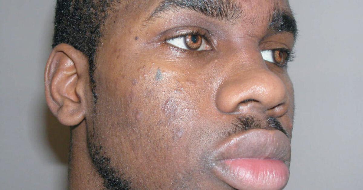 Ten years after he was acquitted, this Toronto man faces a third trial ...