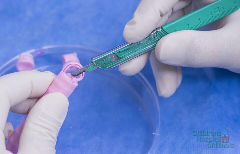 Parents of girl, 2, with windpipe transplant breathe easier