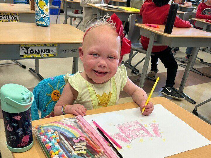 Bella Brave, TikTok star with rare diseases, dies at age 10