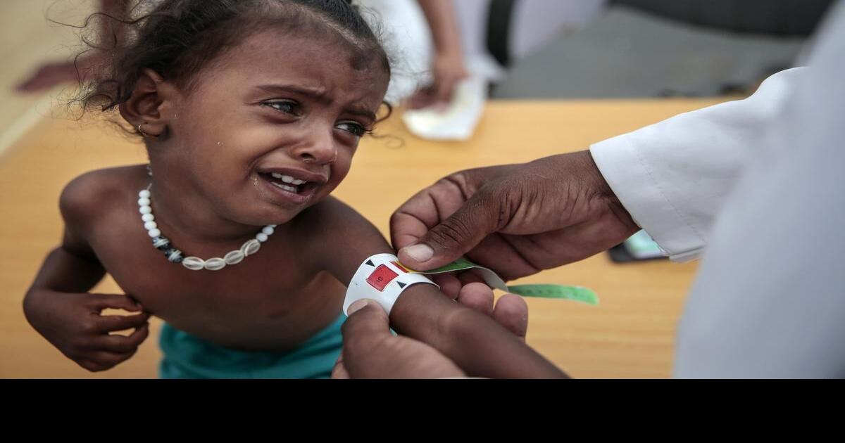 Aid group says 85,000 children may have died of hunger in Yemen