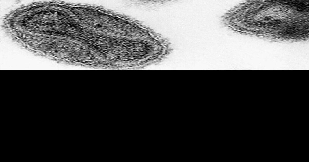Forgotten vials of smallpox from 1950s found in storage room