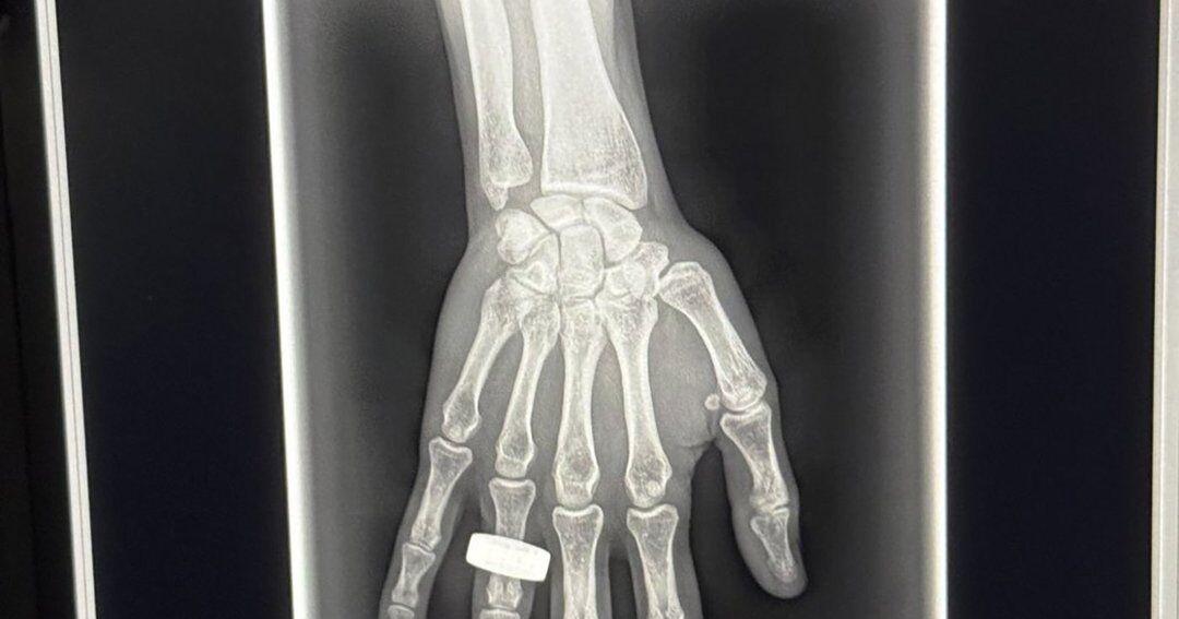 Canadian firm KA Imaging claims first X-ray image taken in space