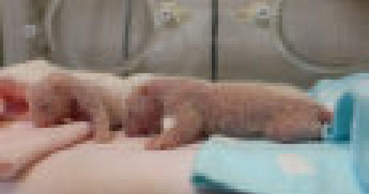 Toronto Zoo's baby pandas healthy after one week