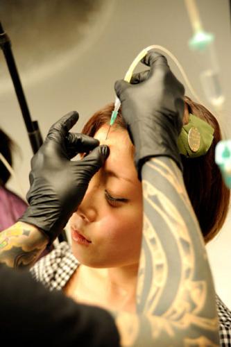 ‘Bagel head’ body modification has roots in Canada