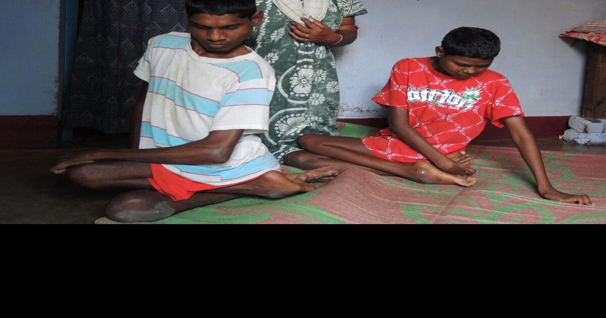 India’s nuclear nightmare: The village of birth defects