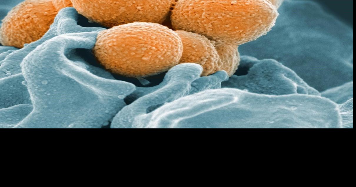 Four children with strep A have died in B.C. in the past month, disease ...