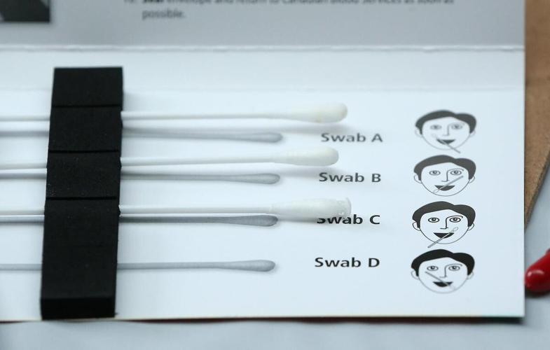 Stem cell donors wanted. Get Swabbed campaign coming to university campuses
