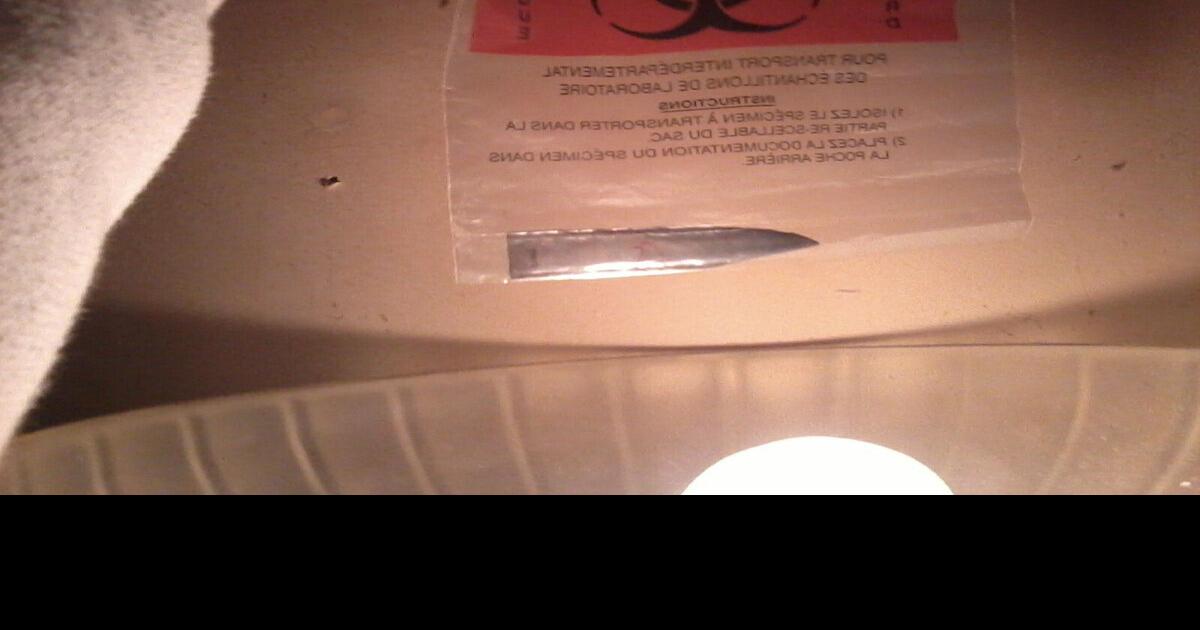 Yellowknife man finds knife blade in his back three years after stabbing