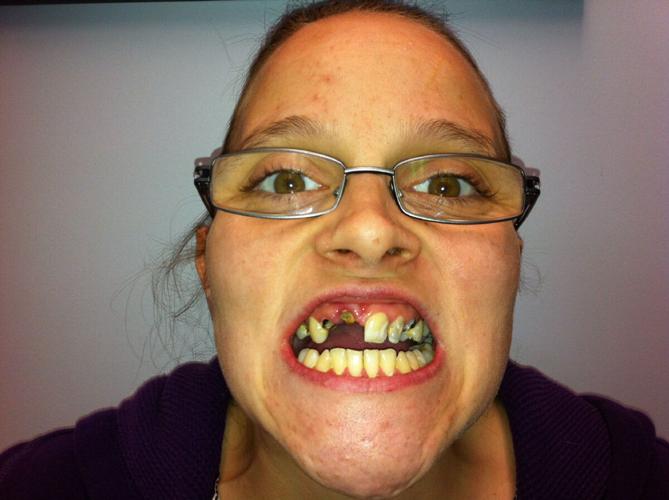 Public dental care sought for needy adults and seniors