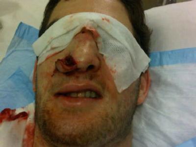 smashed face disease