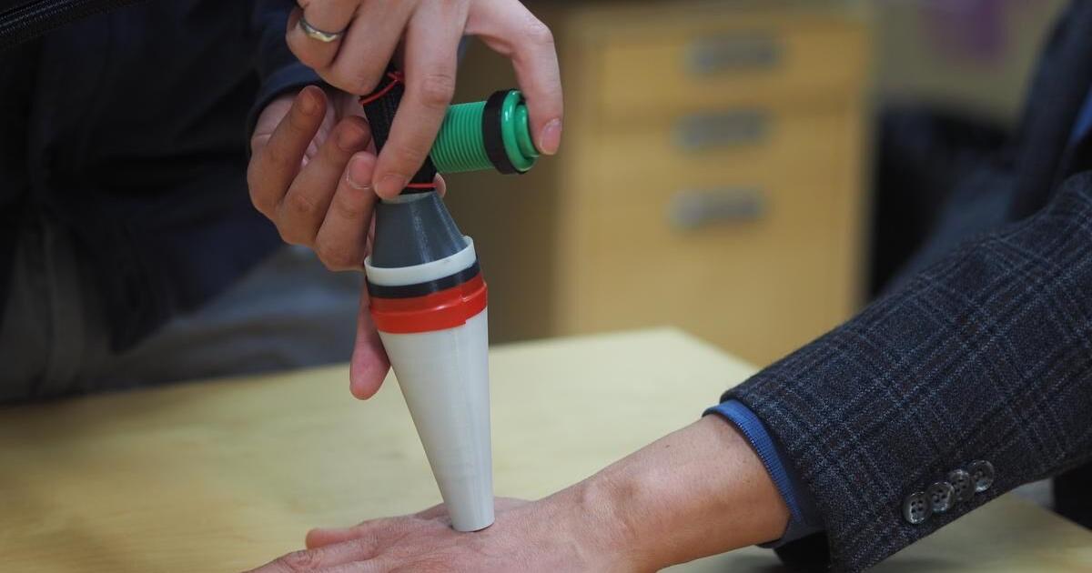 Low-cost laser probe for skin cancer screening developed by UBC ...