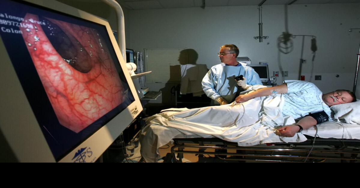 Colonoscopy not needed for routine colorectal cancer screening, task ...