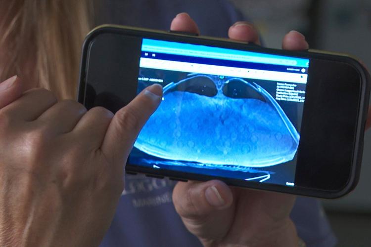 A 302-pound loggerhead sea turtle hit by a boat gets an oversize CT ...