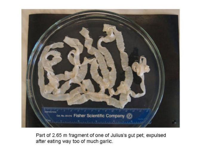 Scientist swallows tapeworm to prove intestinal parasites can be our ...