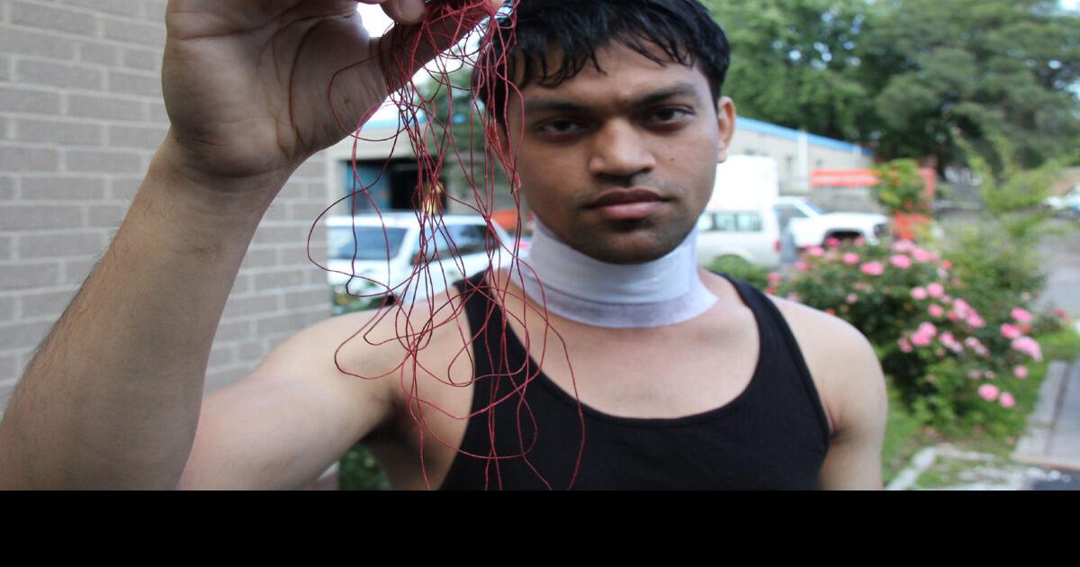 Kite string slices man’s neck