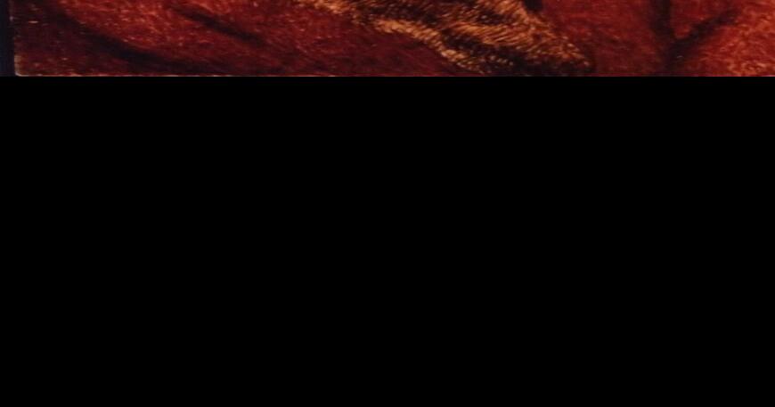 Newfoundland First Nation to study genetic links with ancient Beothuk ...