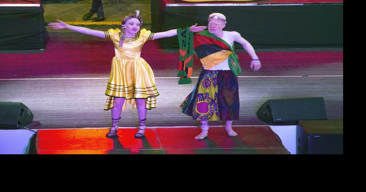 Winner of albinism pageant says Zimbabwe event made her feel beautiful ...