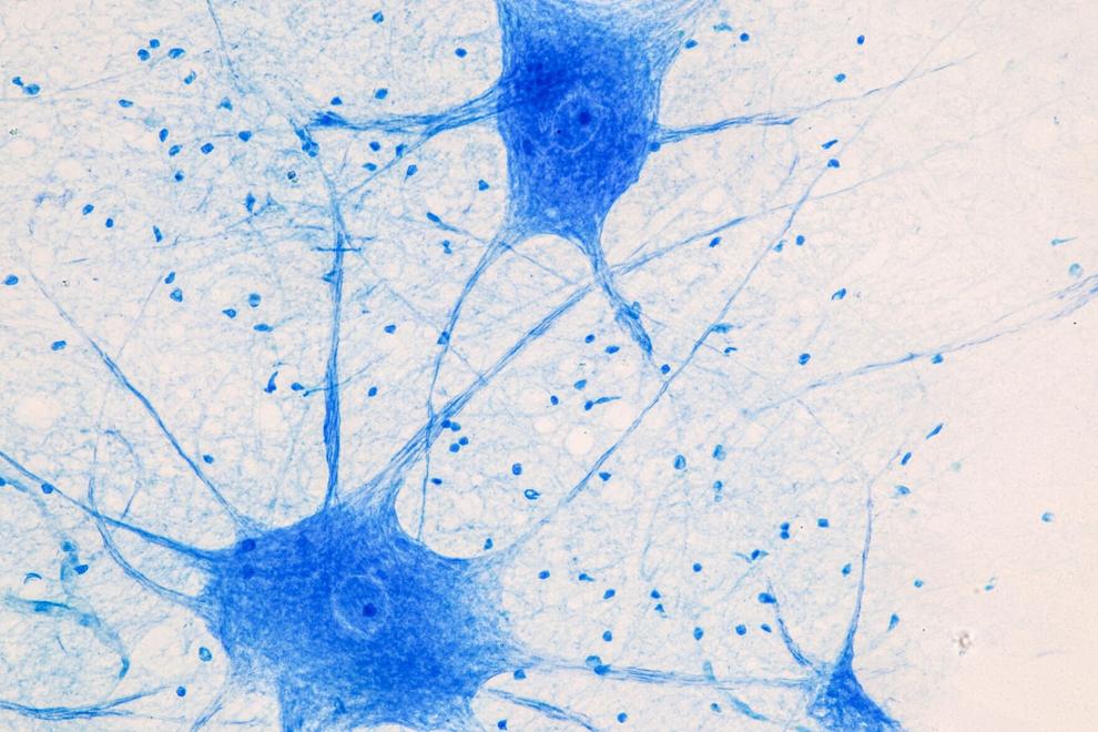 Scientists may have discovered a potential cure for ALS