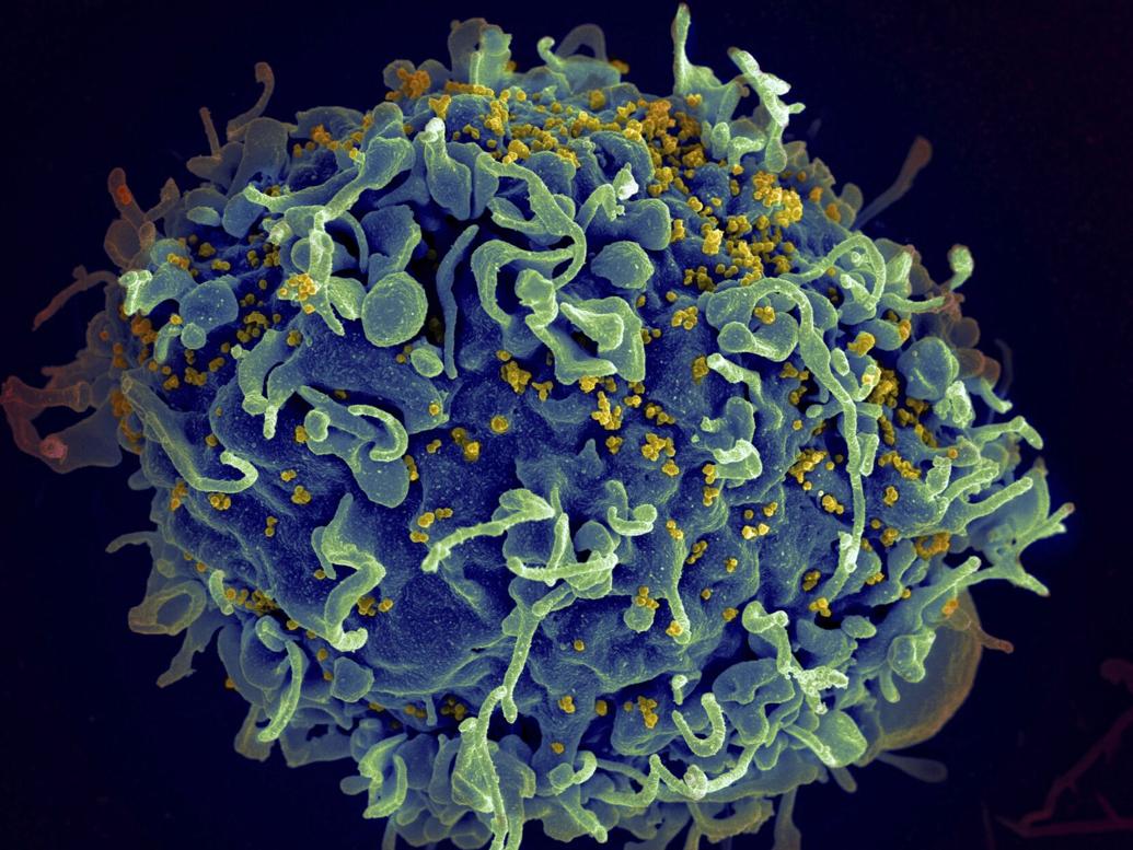 Canadian scientists on the cusp of a cure for HIV