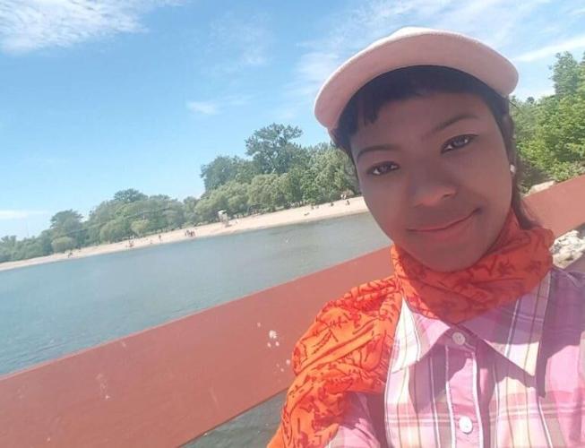 Acid attack survivor who got life-changing surgery in Toronto wants to ...