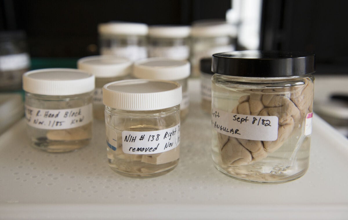 Albert Einsteins Brain In Jar In Search Of Einstein's Brain Big