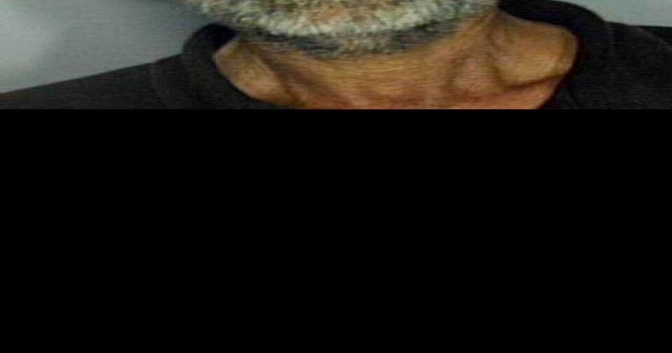 Miami face-eating victim will require many surgeries, skin grafts to ...